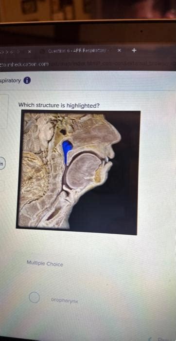 Solved Which Structure Is Highlighted Multiple Choice