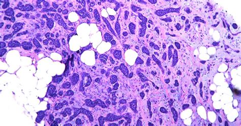 Digital And Computational Pathology Crosscope