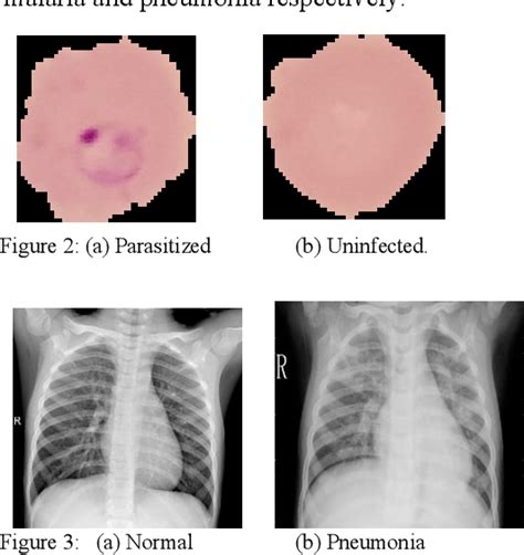 Figure 3 From A Comprehensive Machine Learning Based Ensemble Model For