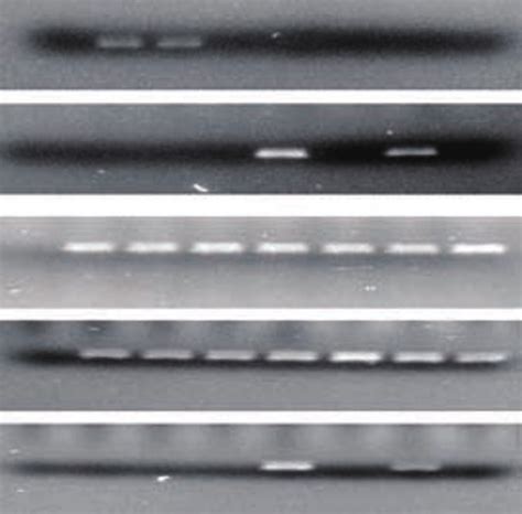 Semi Quantitative Pcr Analysis Of The Constitutively Expressed