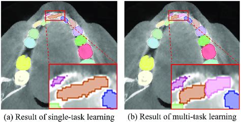 Comparison Of The Multi Task Learning Strategy And The Single Task Download Scientific Diagram