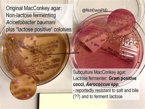 Acinetobacter On Macconkey Agar