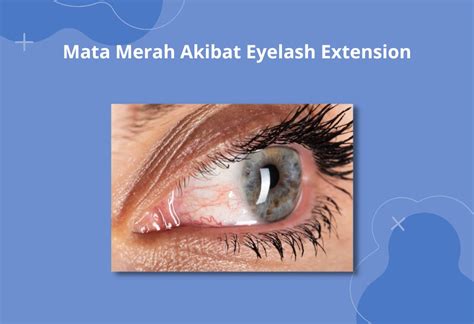 Pemasangan Eyelash Extension Amankah Ini 2 Caranya