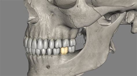 The Mandibular Second Molar Resembles The Mandibular First Permanent