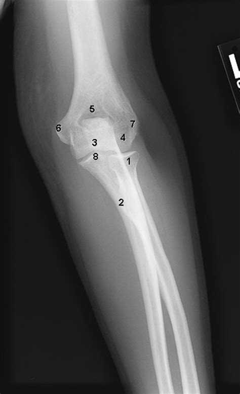 Xray Upper Body
