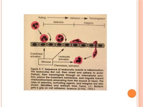 Gingival Inflammation Dr Priya Josepptx
