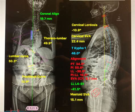 Gallery Precision Spine And Orthopedics Inc
