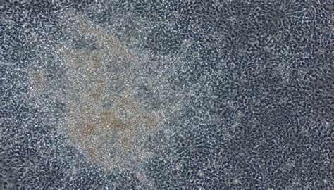 Neural Induction Of Hpscs Using The Embryoid Body Method