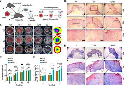 An Injectable Ibuprofen Sustained Release Composite Hydrogel System Ef