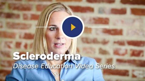 Scleroderma Treatment Options Johns Hopkins Scleroderma Center