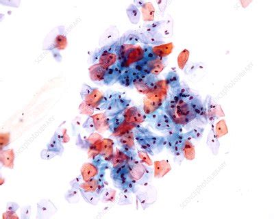 Vaginal Smear Light Micrograph Stock Image C Science Photo Library