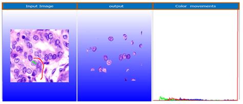 noise reduction using graph cut segmentation download scientific diagram
