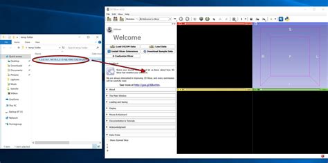 How To Easily And Automatically Convert A Ct Scan Dicom Data Into A 3d Printable Medical Model