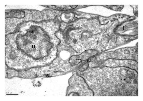 Scanning Electron Microscopy Sem And Transmission Electron Microscopy
