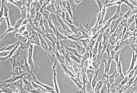 血管内皮细胞 白细胞吞噬细菌动态图 白细胞吞噬细菌 第2页 大山谷图库