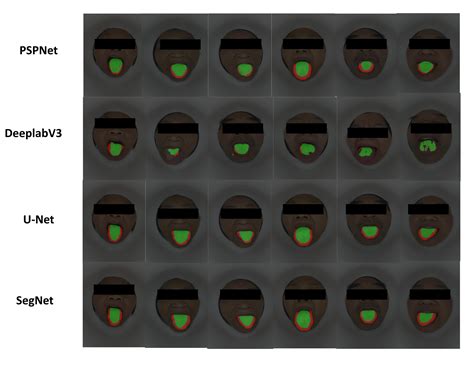 Objectification Of Tongue Diagnosis In Traditional Medicine Data