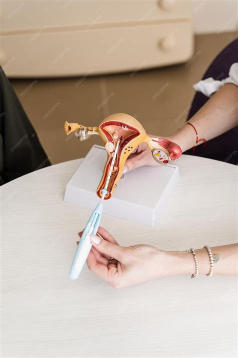 Inserção Aproximada De Dispositivo Intrauterino Diu Em Seu Modelo De