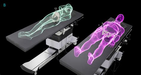 What Is Patient Registration And How Do Different Methods Compare Navbit