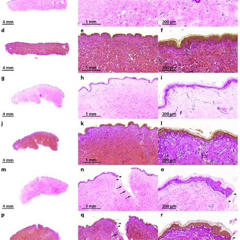 Hematoxylin Eosin He And Elastica Van Gieson Evg Staining Of