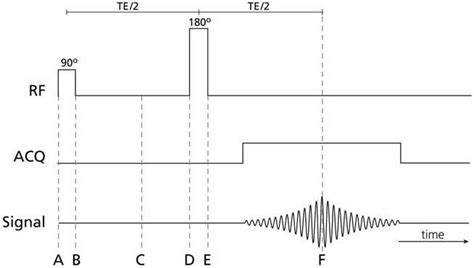 12 Spin Echo Pulse Sequence Diagram [kwong 06] The Signal Is Acquired Download Scientific
