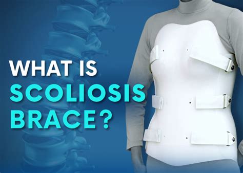Scoliosis Braces Can Scoliosis Be Corrected With A Brace Turanandturan