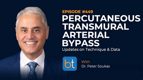 Ptab A New Percutaneous Technique By Dr Soukas Backtable Vascular And Interventional Posted