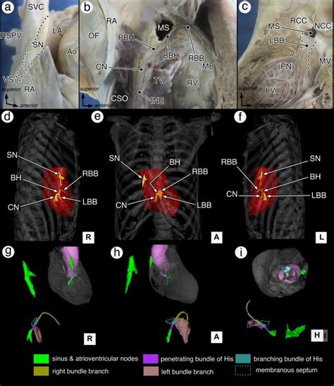 Unleashing The Power Of 3d Table In Anatomy Education