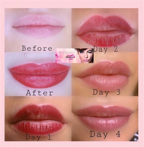 Lip Tattoo Makeup Before And After Saubhaya Makeup