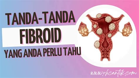 Tanda Tanda Fibroid Dan Cyst Yang Sis Wajib Tahu