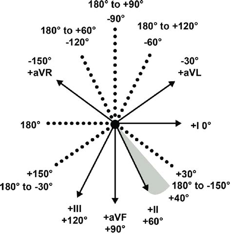 The Frontal Plane Limb Leads Conventionally Represented On A Hexaxial Download Scientific