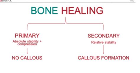 Bone Fracture And Healing Flashcards Quizlet