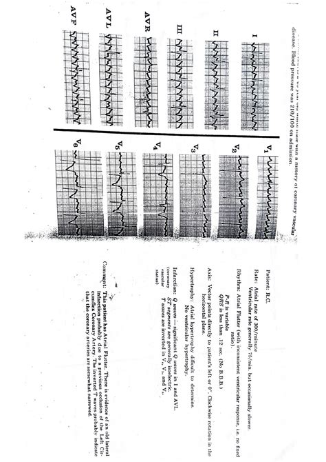 SOLUTION Ecg Rates Studypool