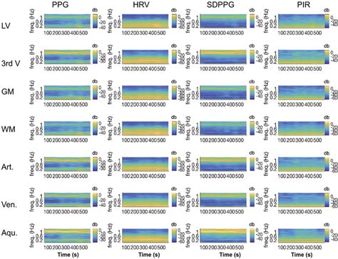 Cross‐spectrograms Linking Ppg‐derived Signals And Fmri Signals In Download Scientific Diagram