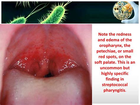 Ppt Microbiology Lab Powerpoint Presentation Free Download Id 2052240