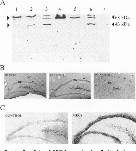 Allocortex Semantic Scholar