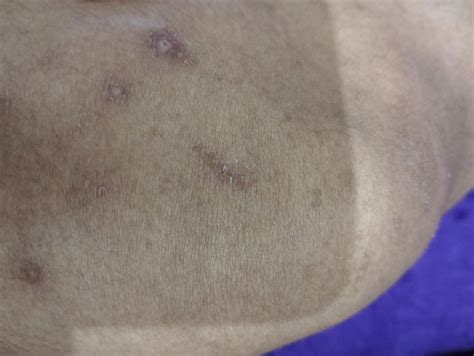 Eksim Bukan Hellosehat