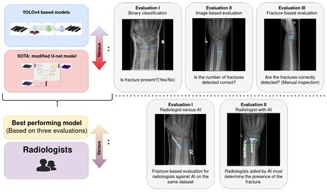 Fracture Recognition In Paediatric Wrist Radiographs An Object Detection Approach Center For