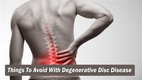 Things To Avoid With Degenerative Disc Disease Healthteps