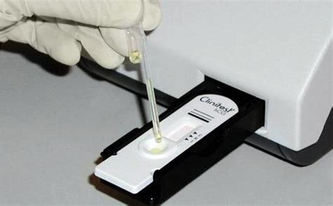 Proper Testing Technique For The Clinitest Hcg Pregnancy Test Siemens Healthineers Usa
