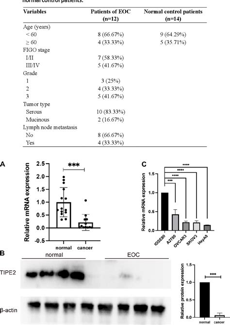 Table 1 From Tipe2 Acts As A Tumor Suppressor And Correlates With Tumor Microenvironment