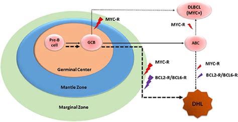 The Cytogenetic Pathogenesis Of Dhl And Myc Dlbcl In The Germinal