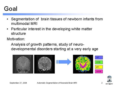 Automatic Segmentation Of Neonatal Brain Mri Marcel Prastawa
