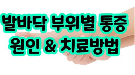 발바닥 통증 부위별 원인과 치료방법 발가락 앞쪽 앞꿈치 중앙 가운데 뒤꿈치 뒤쪽 Youtube