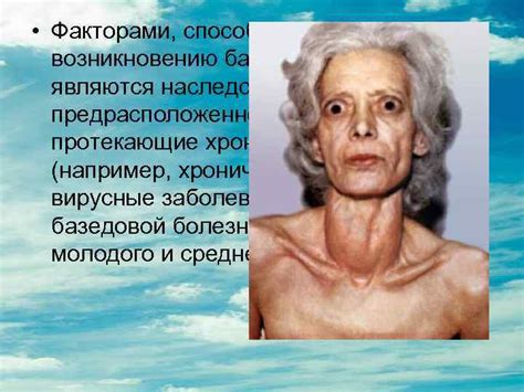 Базедова болезнь Базедова болезнь или