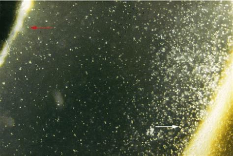 Methylcellulose Culture With Tmp Smx Red Arrow Tmp Smx Pad White