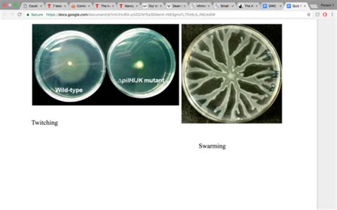 Lab Quiz 1 Microbio Flashcards Quizlet