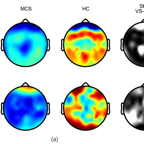 A Brain Topography And Statistical Analysis Between Groups Of