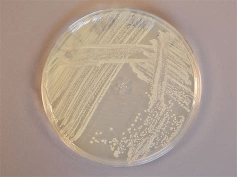 Citrobacter Freundii Classroom Bacterial Identification Wiki Fandom
