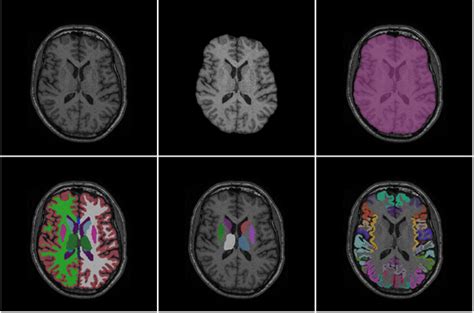 Github Htylab Tigerbx Deep Learning Framework For Mri Segmentation