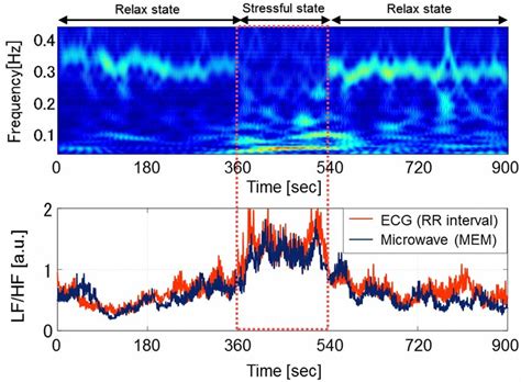 Wavelet Spectrum Of The Hrv Upper Trace Lfhf As A Function Of Time